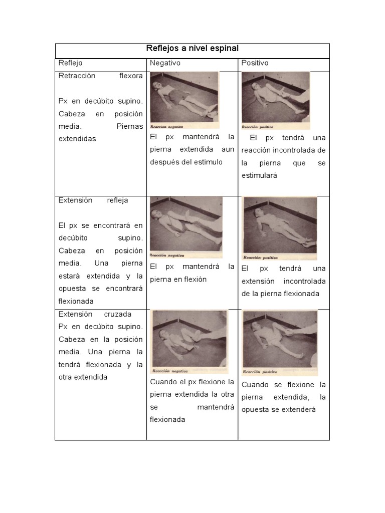 Reflejos A Nivel Espinal | PDF