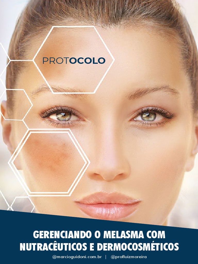 Protocolo Completo para Tratamento do Melasma | PDF | Ácidos orgânicos | Compostos orgânicos