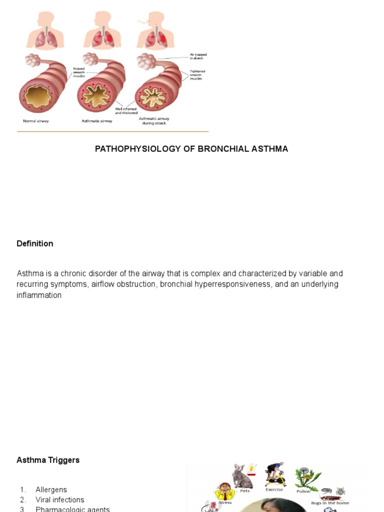Bronchial Asthma | PDF | Asthma | Inflammation