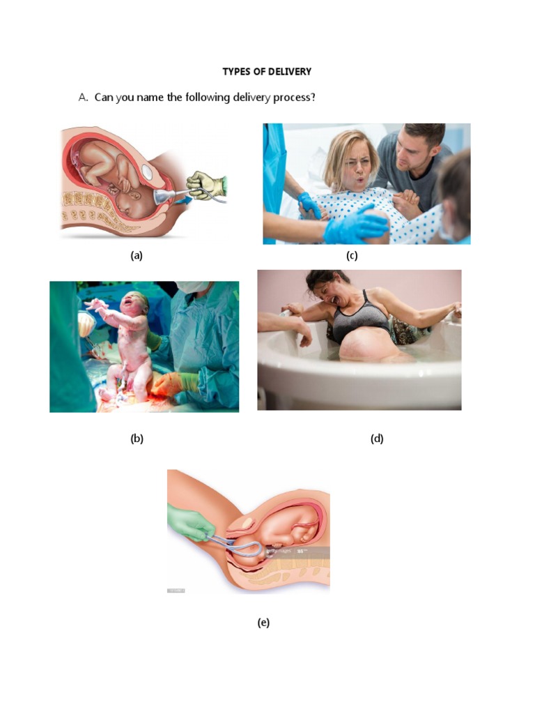 Types of Delivery | PDF | Childbirth | Caesarean Section