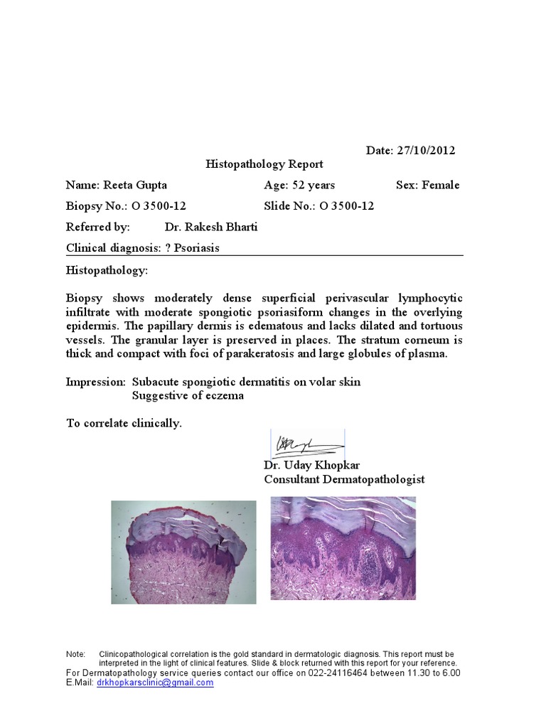 1010_O 3500-12_Rita Gupta_Subacute Spongiotic Dermatitis on Volar Skin ...