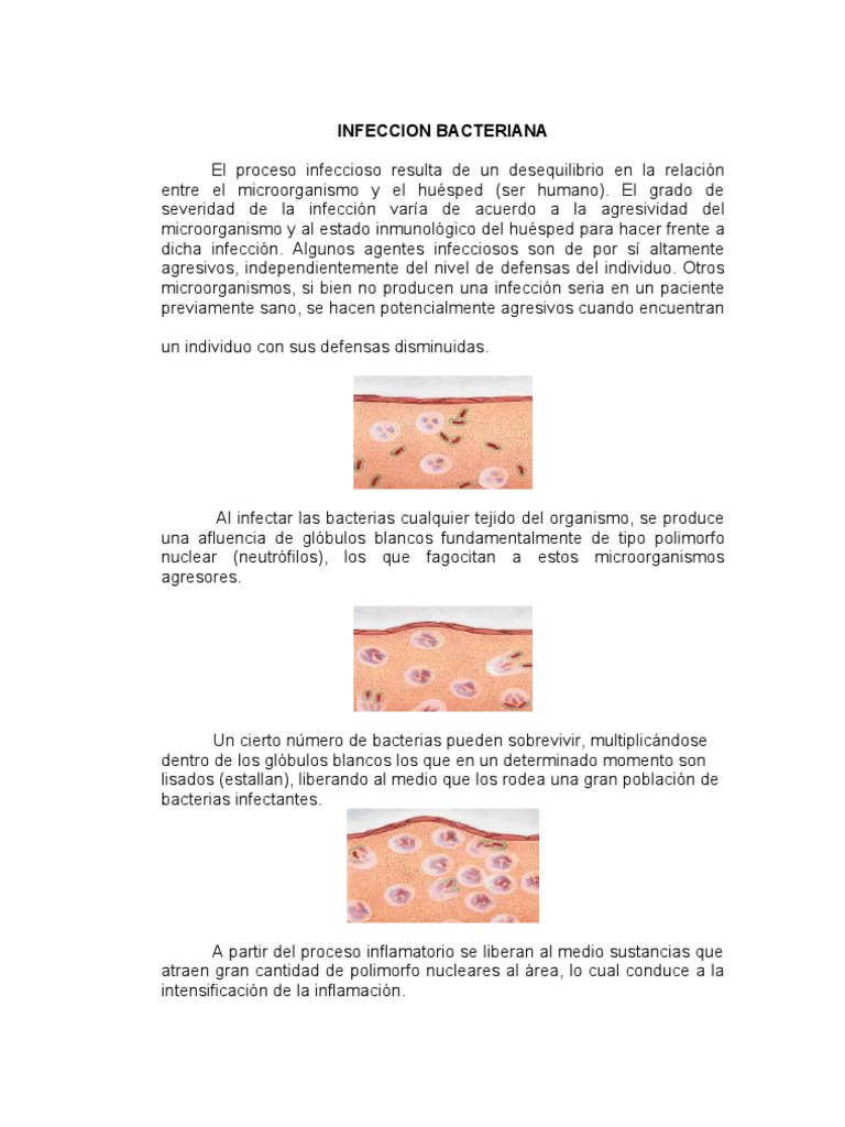 INFECCION BACTERIANA