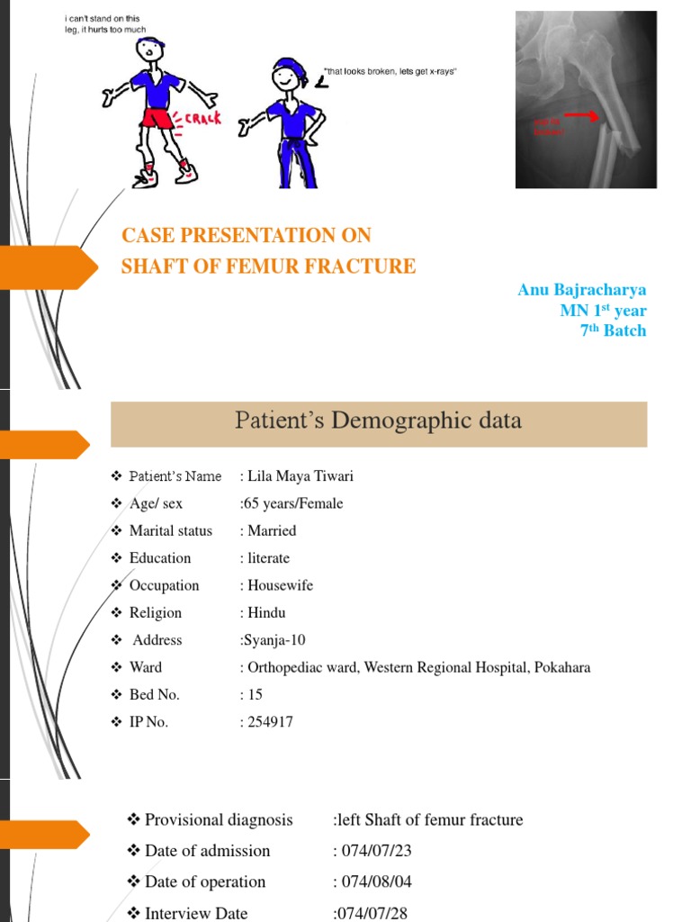 Case Presentation: Femur Shaft Fracture | PDF | Bone | Skeletal System