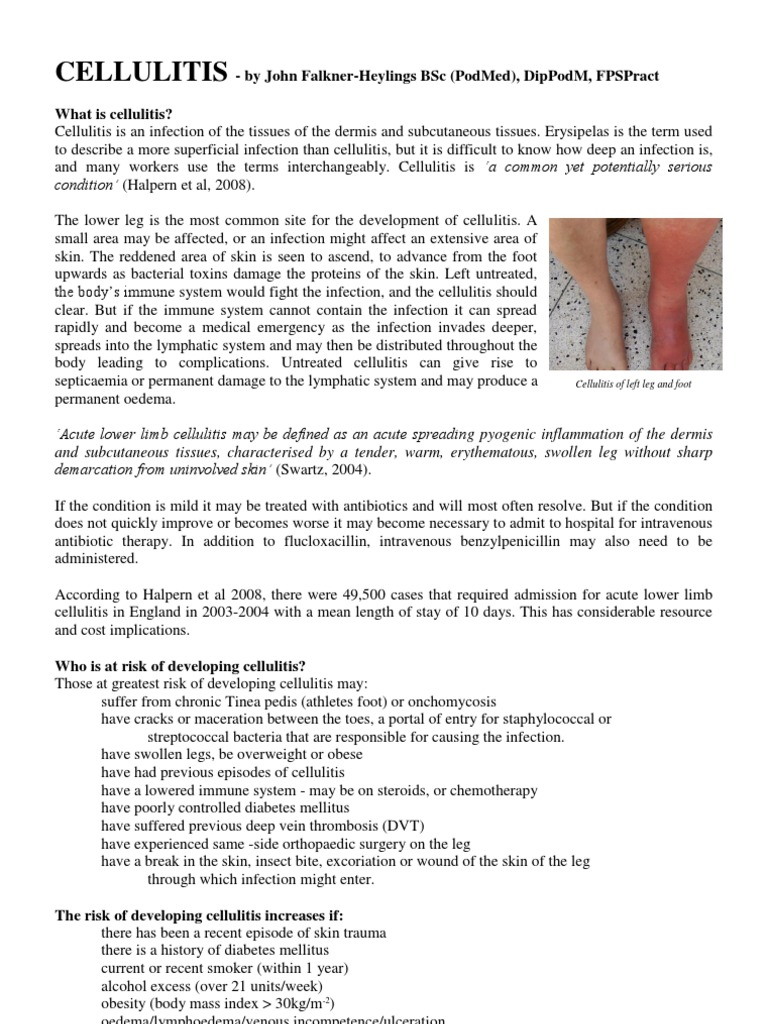 Cellulitis | Medical Specialties | Clinical Medicine