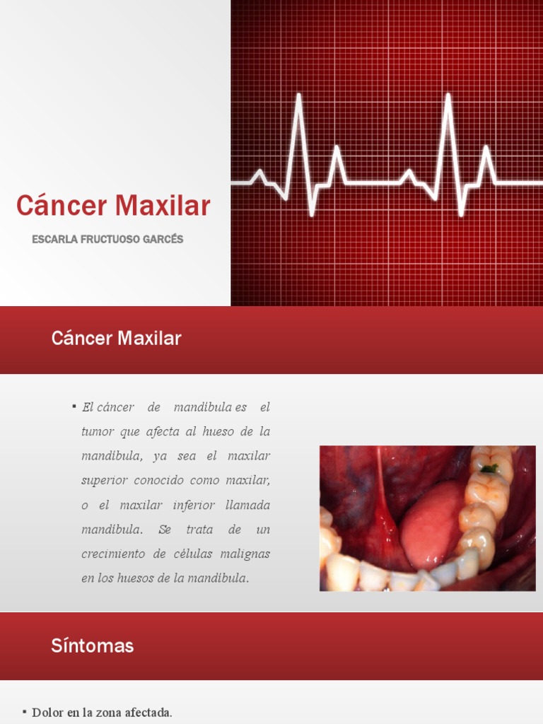 Cáncer Maxilar | PDF | Salud y bienestar | Ciencia y matemáticas