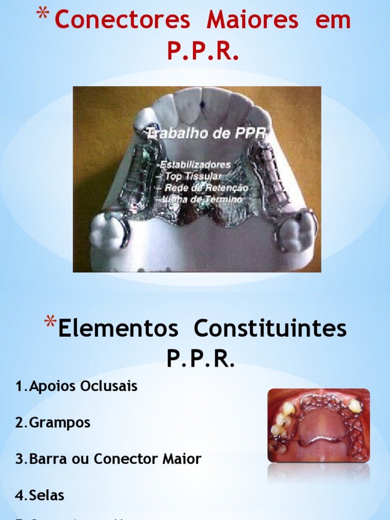 Conectores Maiores em Prótese PPR | PDF