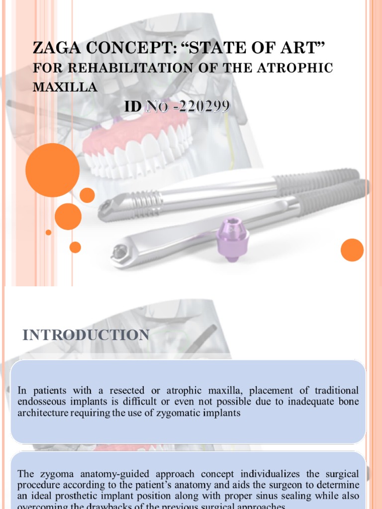 Zaga Concept | PDF | Dental Implant | Surgery