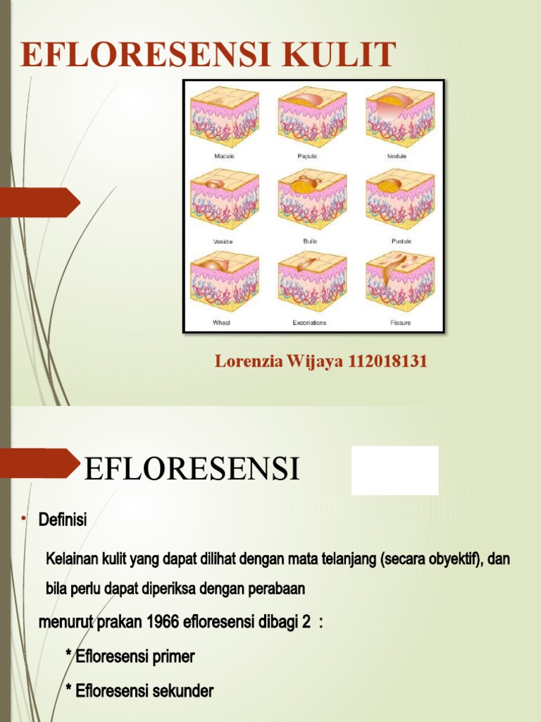 Efloresensi Kulit - Lorenzia Wijaya | PDF