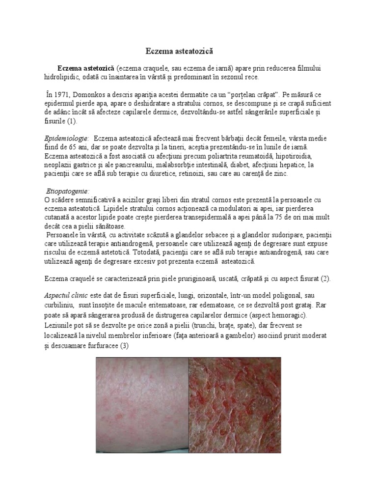 Eczema Asteatozică | PDF