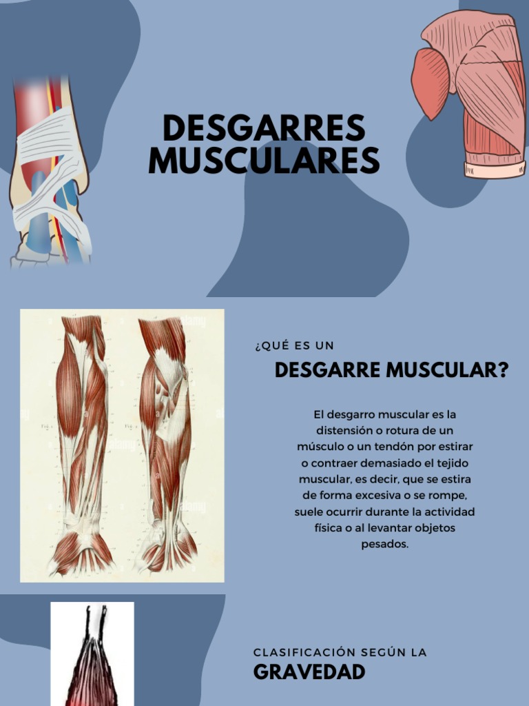 Tipos y Tratamiento del Desgarro Muscular | PDF | Músculo esquelético ...