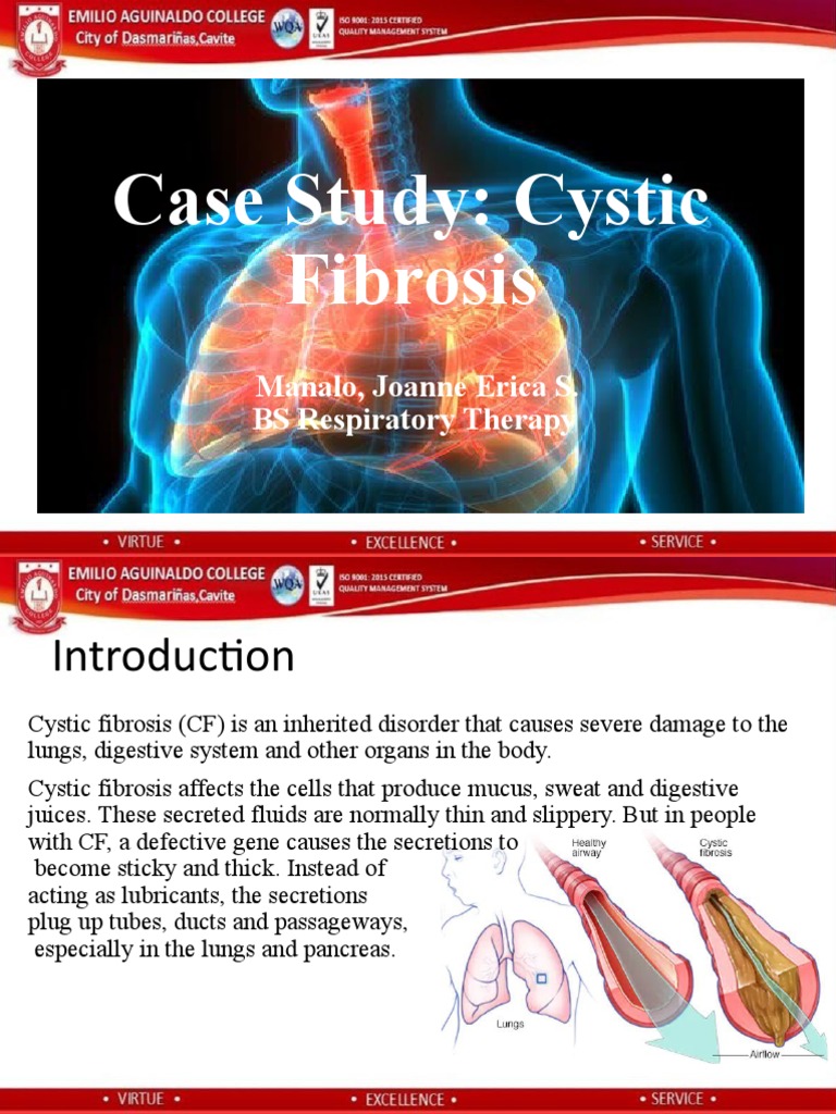 Case Study: Cystic Fibrosis: Manalo, Joanne Erica S. BS Respiratory ...