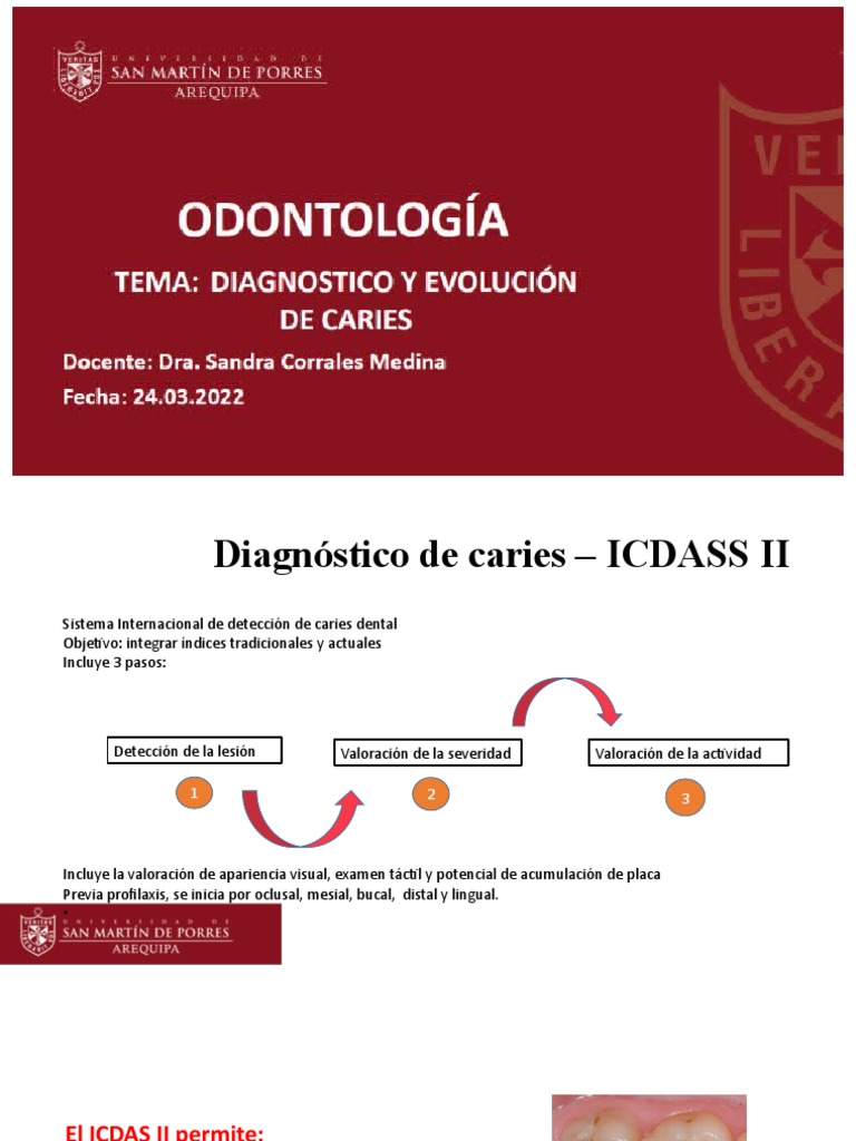 ICDAS | PDF