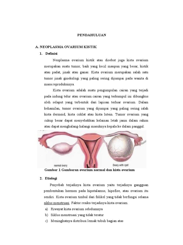 LP Ginek Neoplasma Ovarium | PDF