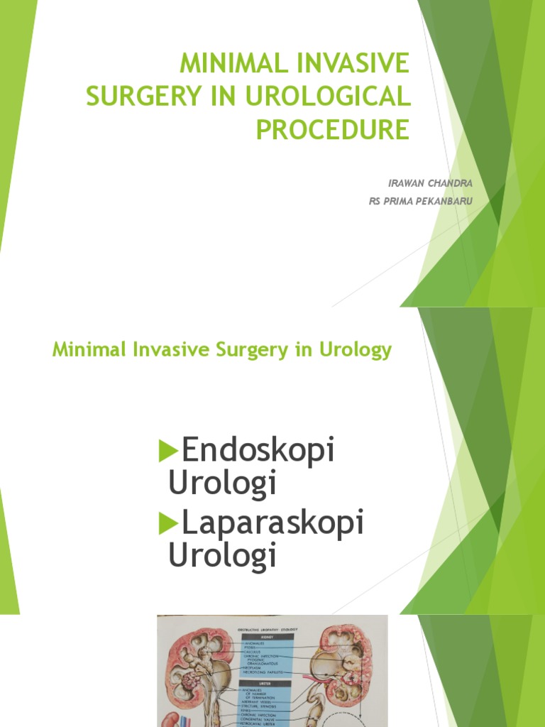 Prosedur Urologi Minimal Invasi | PDF