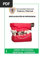 Exposición Sliding Jig | PDF | Ortodoncia | Anatomia dental