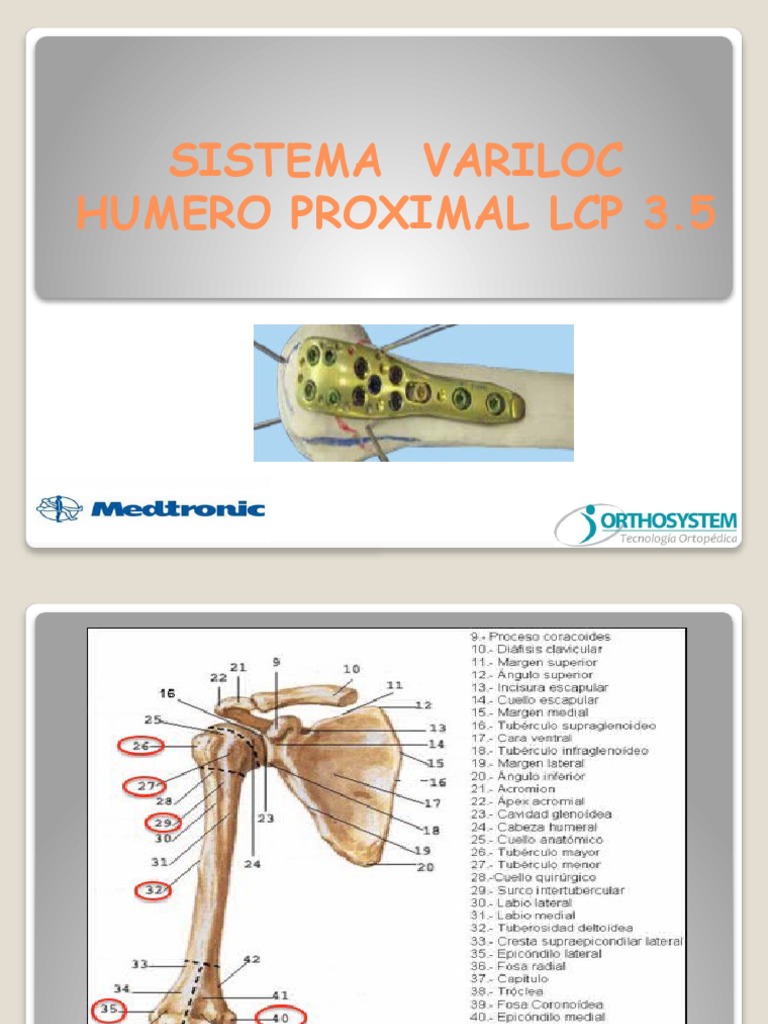 Presentacion Variloc Humero | PDF