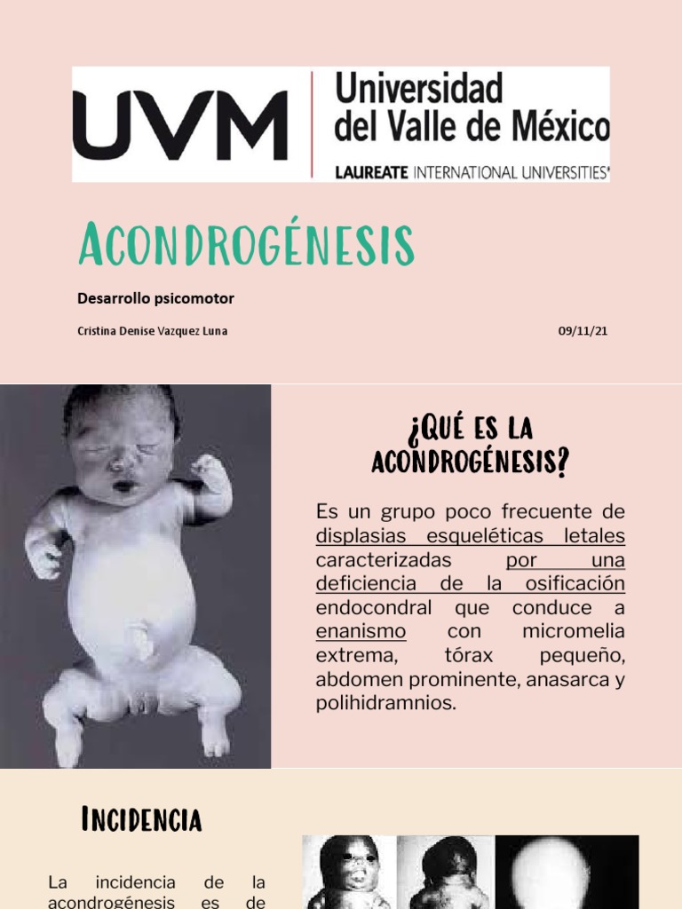 Acondrogénesis | PDF | Ultrasonido médico | Enfermedades y trastornos