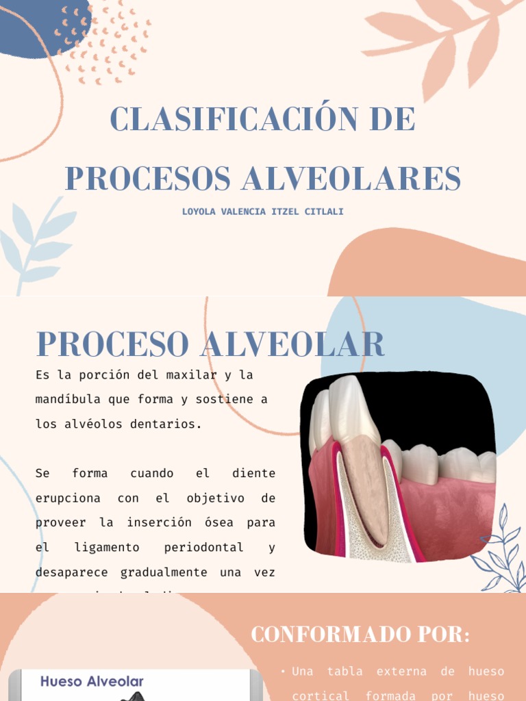 Clasificación de Procesos Alveolares | PDF | Hueso | Ramas de Odontología