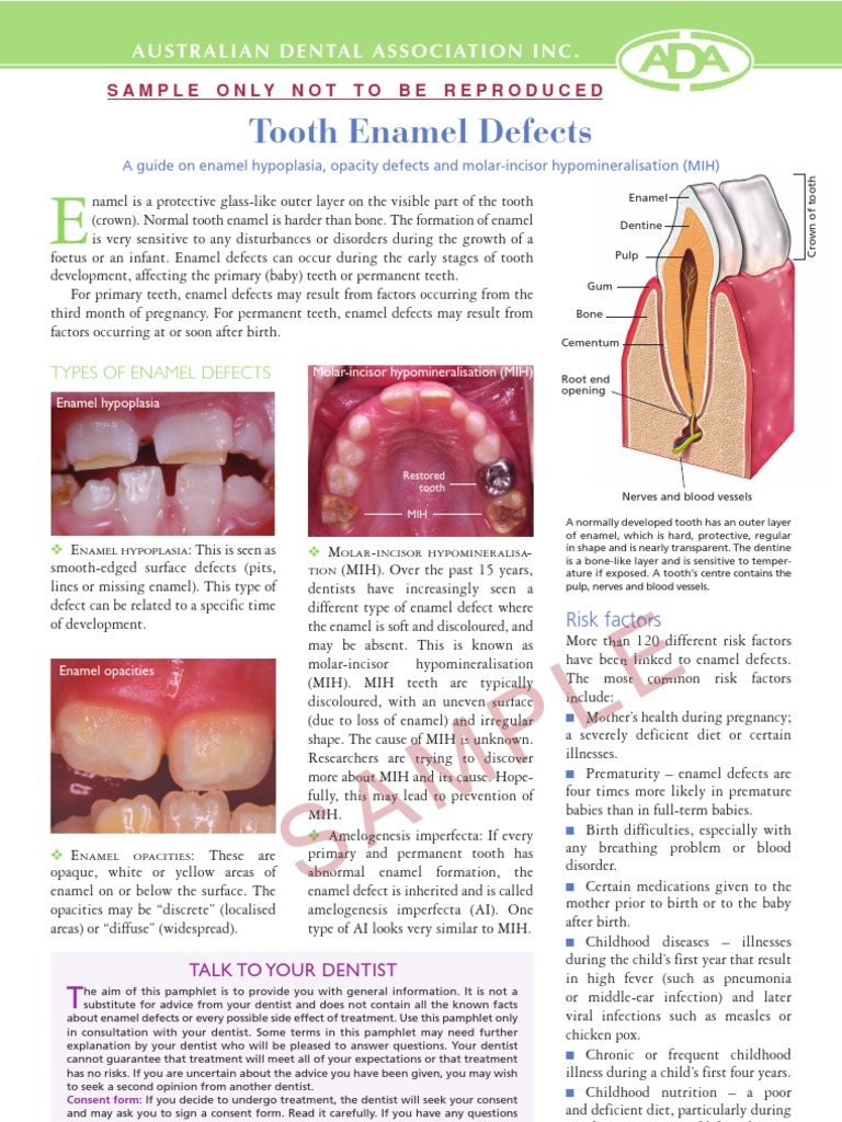 Tooth Enamel Defects | PDF | Human Tooth | Tooth Enamel