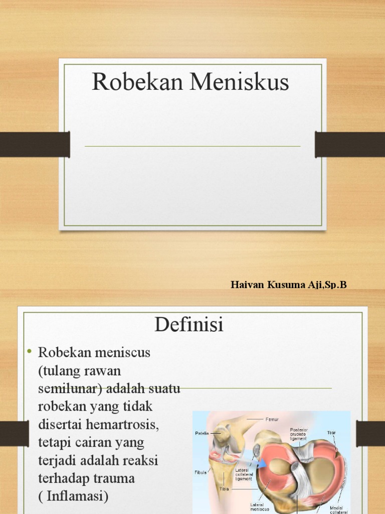 Robekan Meniscus | PDF