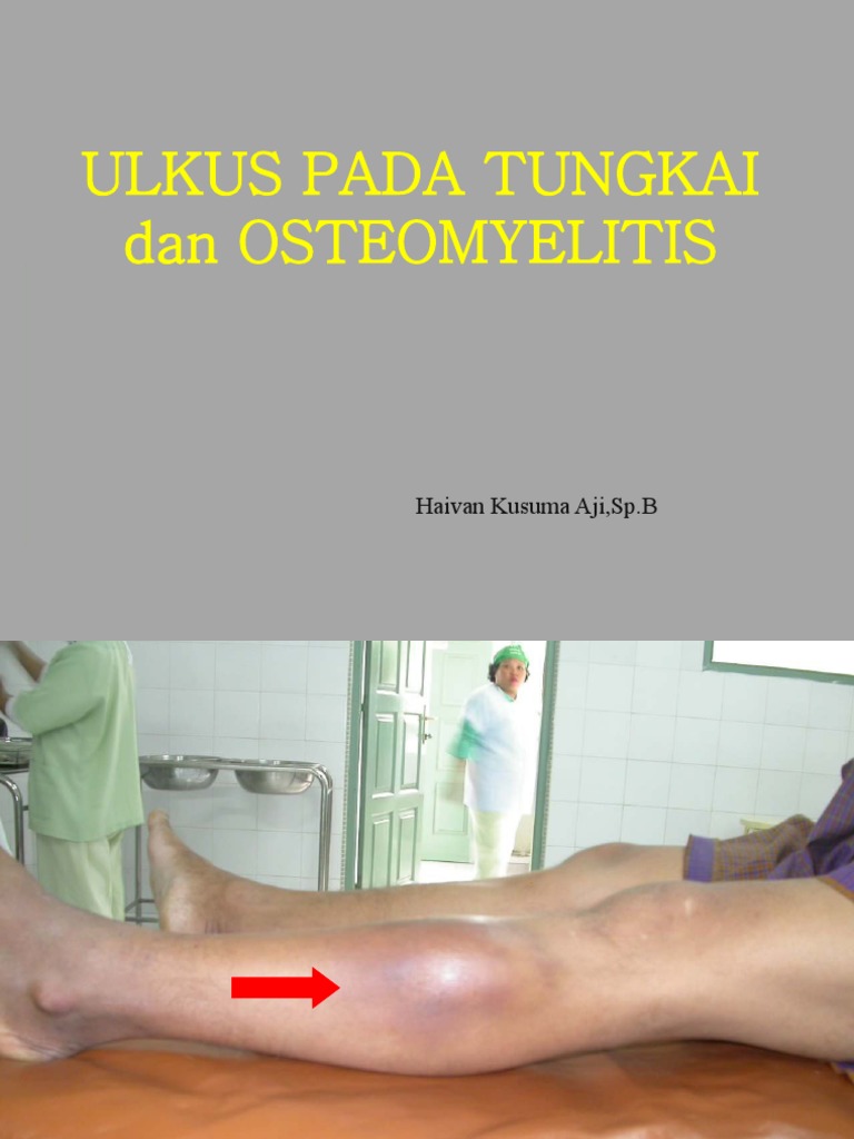 Ulkus Tungkai Dan Osteomyelitis | PDF