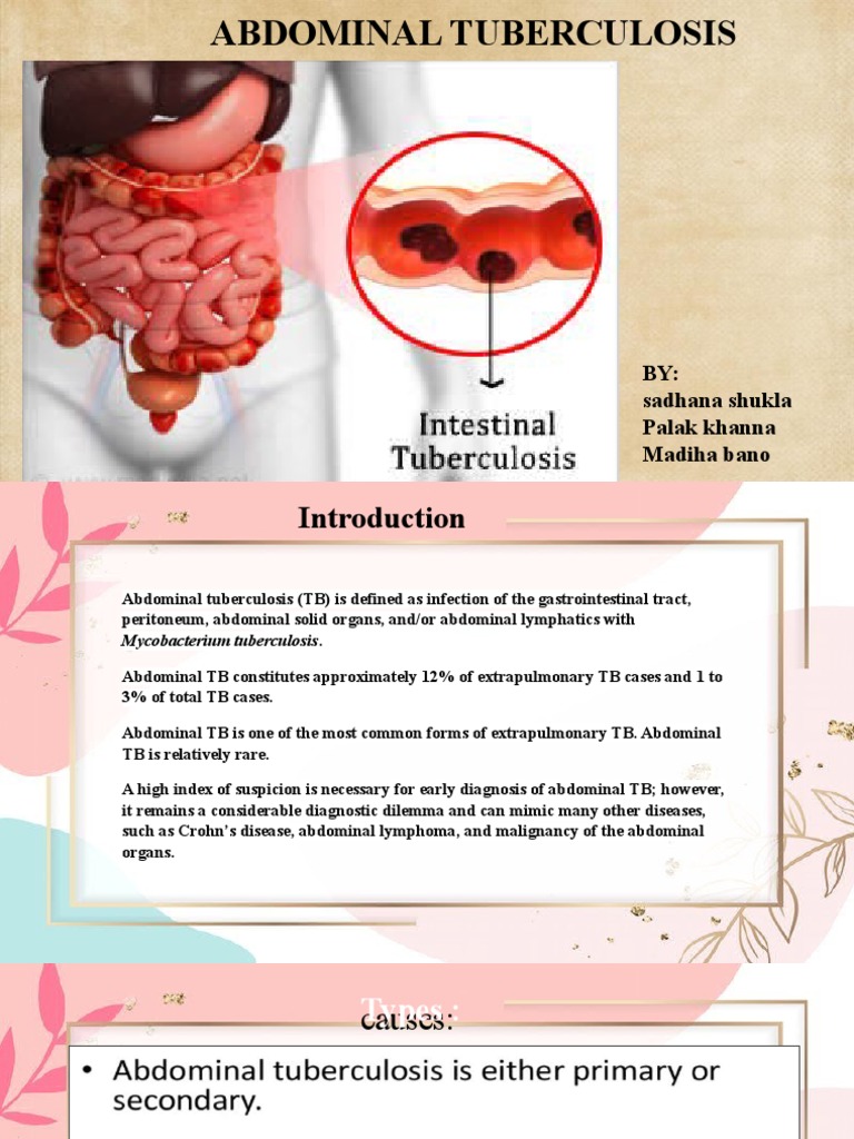 Abdominal Tuberculosis | PDF | Tuberculosis | Ct Scan