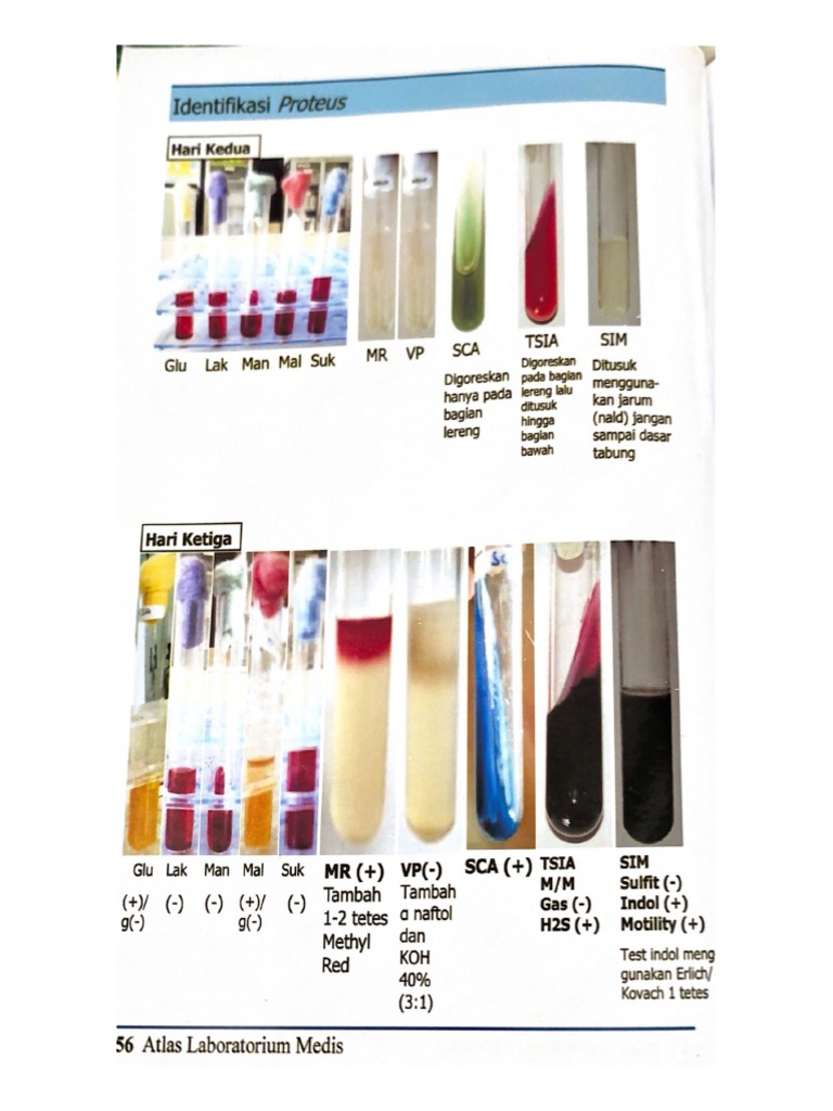 Identifikasi Proteus | PDF