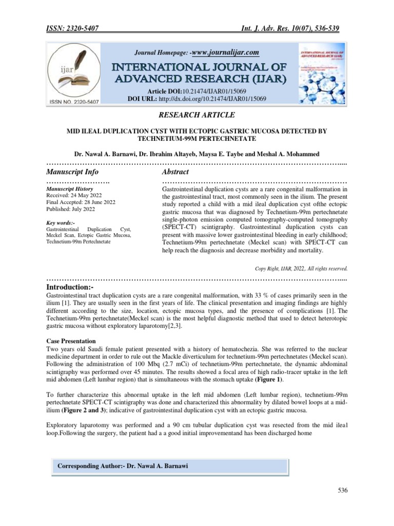 Mid Ileal Duplication Cyst With Ectopic Gastric Mucosa Detected by ...