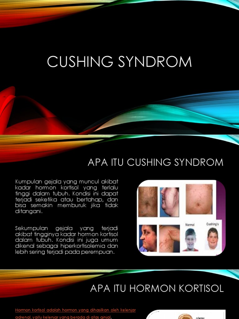Cushing Syndrom | PDF