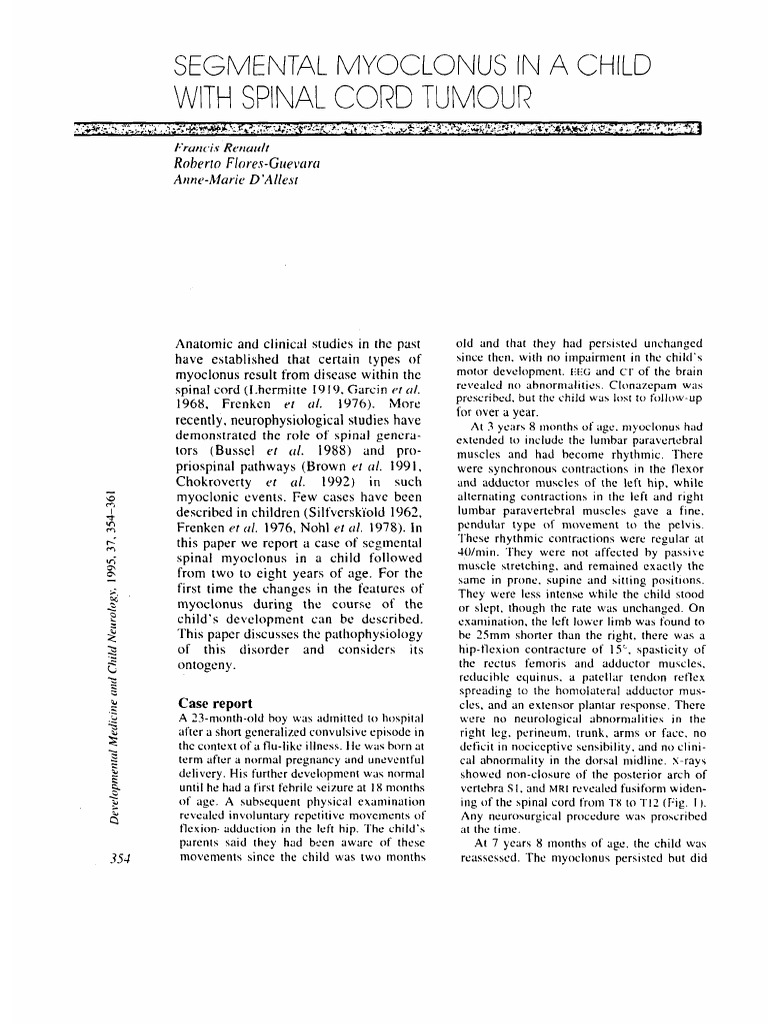 SEGMENTAL MYOCLONUS IN A CHILD With Spinal Tumor | PDF | Anatomical ...