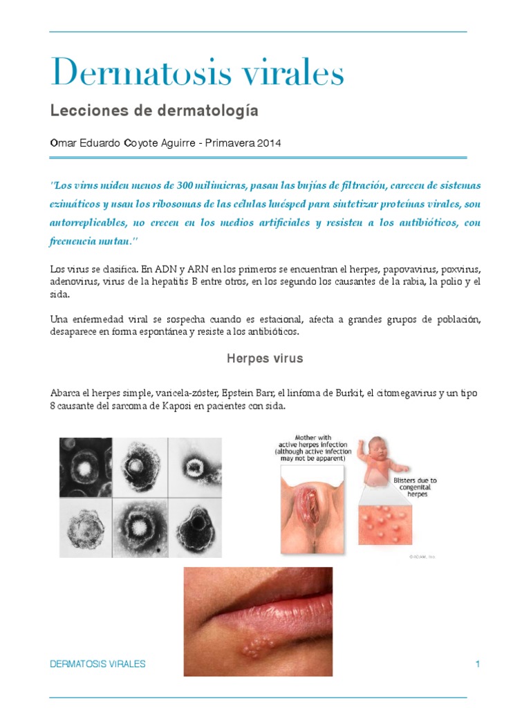 Dermatosis virales | PDF | Virus | Herpes Simple
