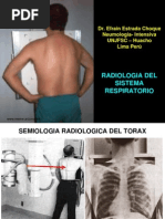 6 Pasos para Interpretar Una Radiografia de Torax | PDF | Tórax | Pulmón