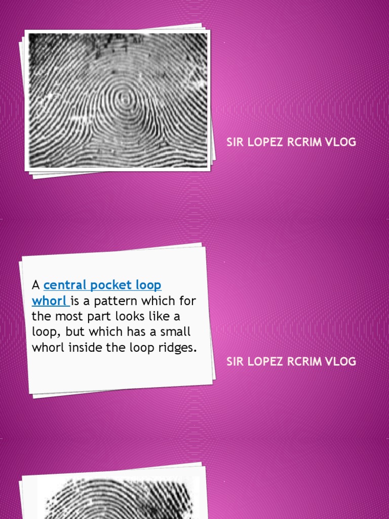 Central Pocket Loop Whorl | PDF
