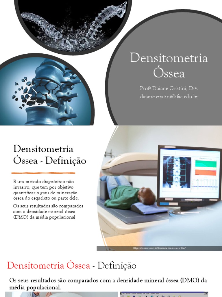 Densitometria Óssea: Diagnóstico e Indicações | PDF | Osteoporose ...