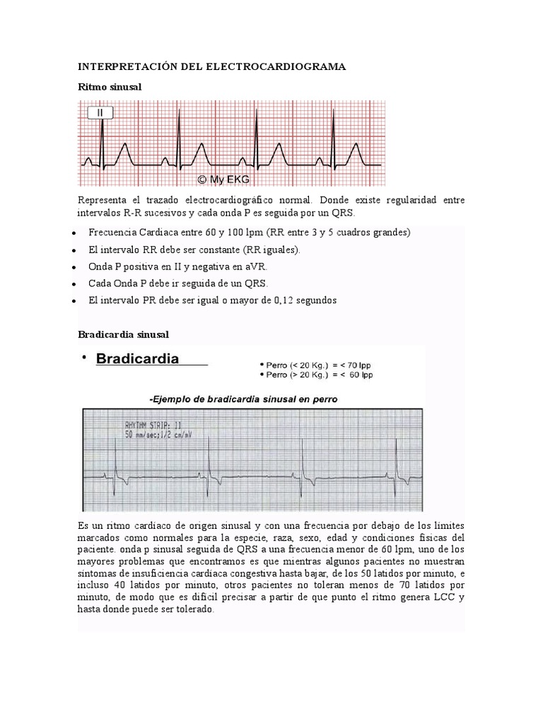 Interpretación Del Electrocardiograma | PDF | Electrocardiografia ...