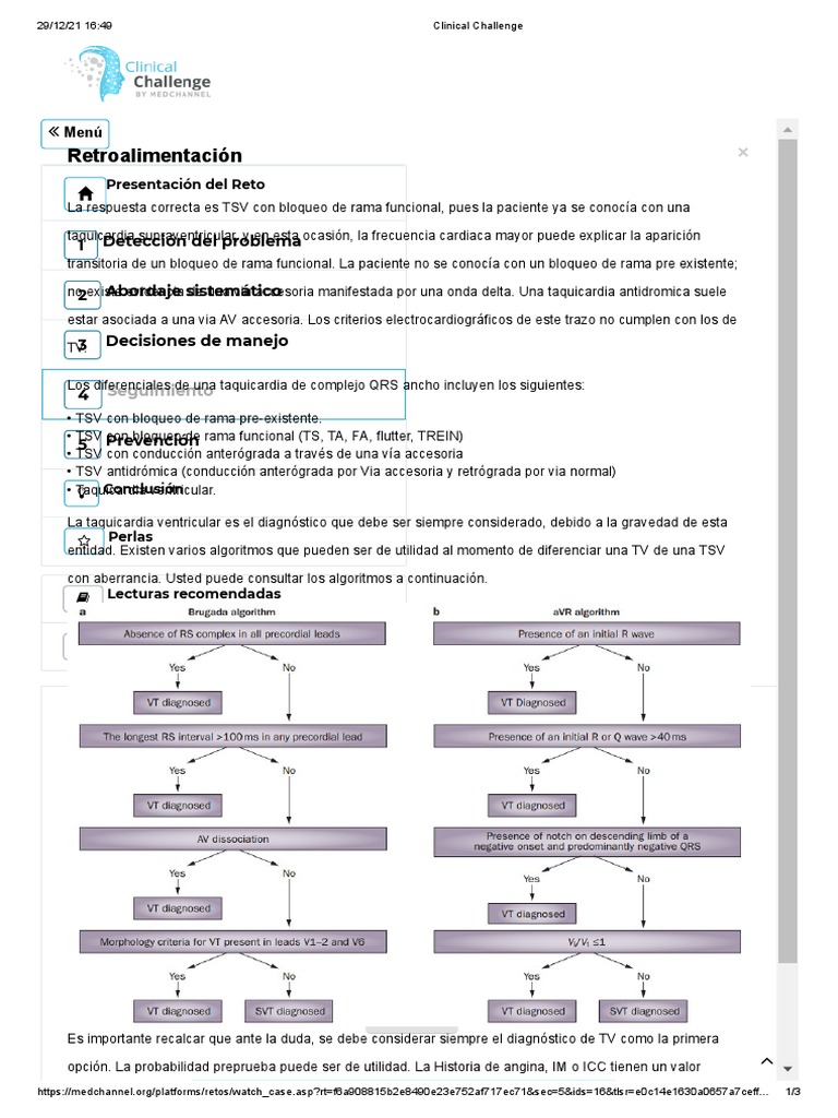 Arritmias TSPV Con Qrs Ancho | PDF | Electrocardiografia | Corazón