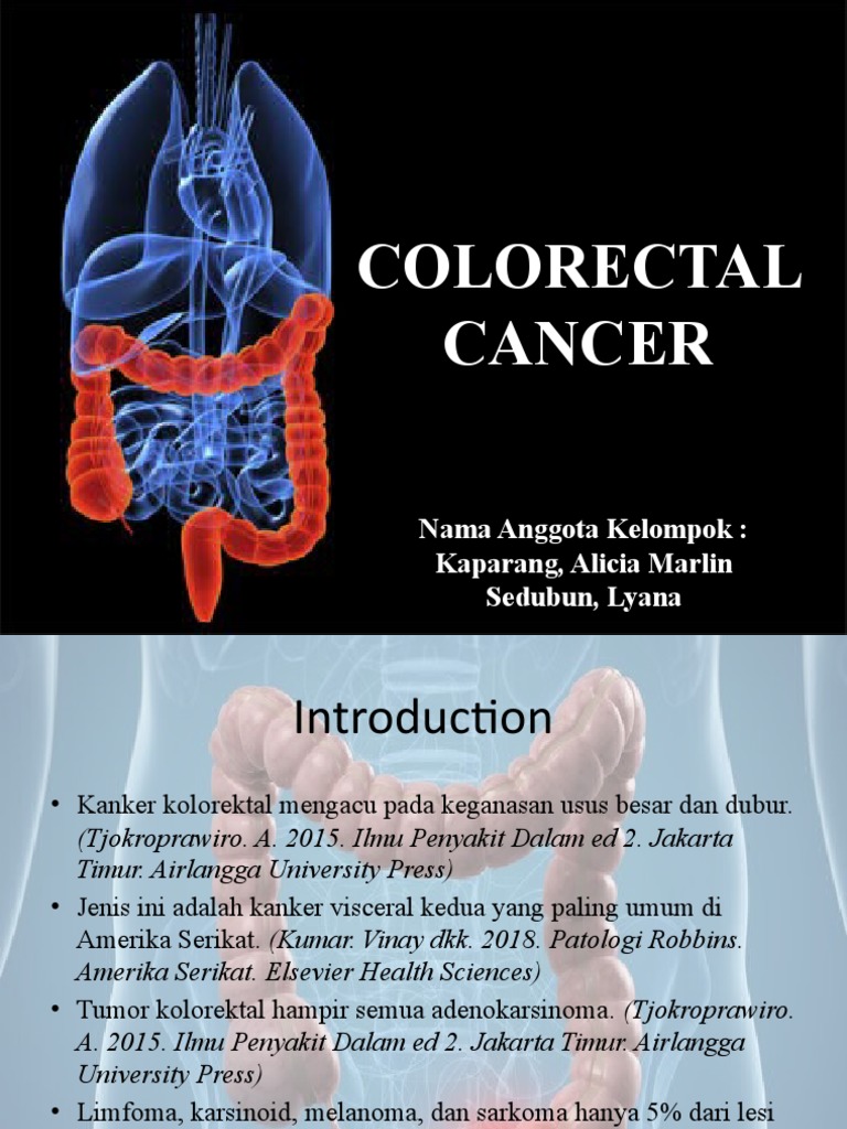 Colorectal Cancer | PDF