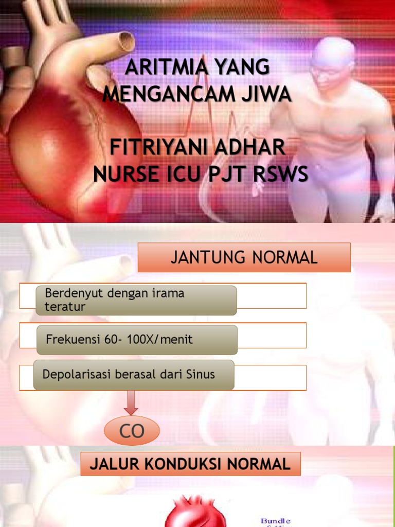 Aritmia Mengancam Jiwa | PDF