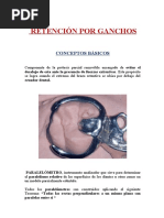 Efecto Ferula en Protesis Fija | PDF | Dentadura postiza | Boca