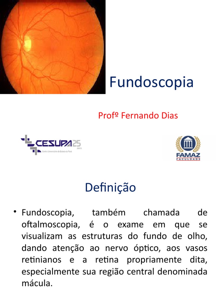 Fundos | Download grátis PDF | Ótica | Olho
