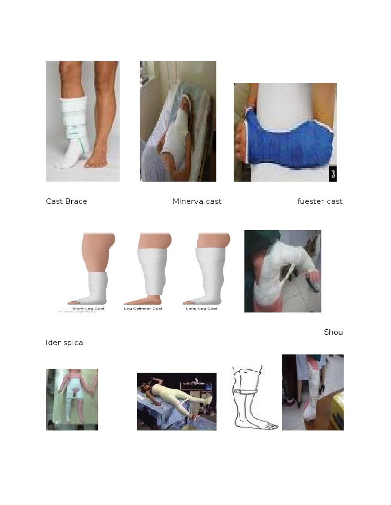 Orthopedic Cast Types Guide | PDF