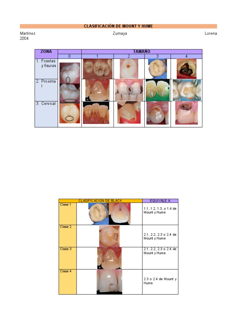 Clasificacion de Cavidades Mount y Hume | PDF