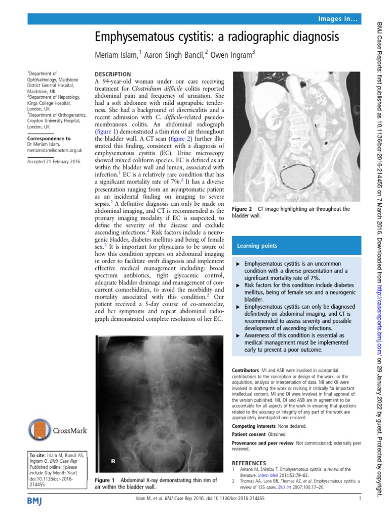 Emphysematous Cystitis: A Radiographic Diagnosis: Meriam Islam, Aaron ...