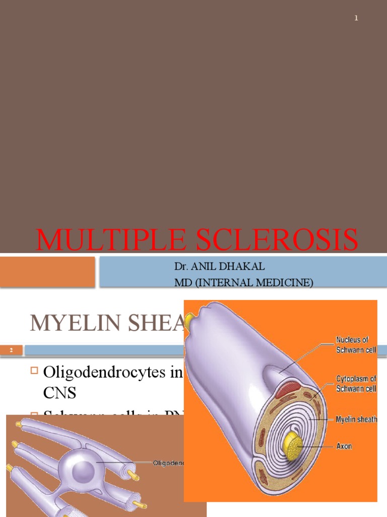 Multiple Sclerosis Dr Anil Dhakal Md Internal Medicine Pdf 5609