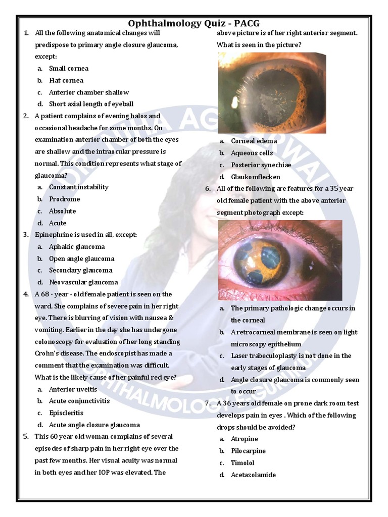 Ophtha Quiz - PACG | PDF | Glaucoma | Ophthalmology
