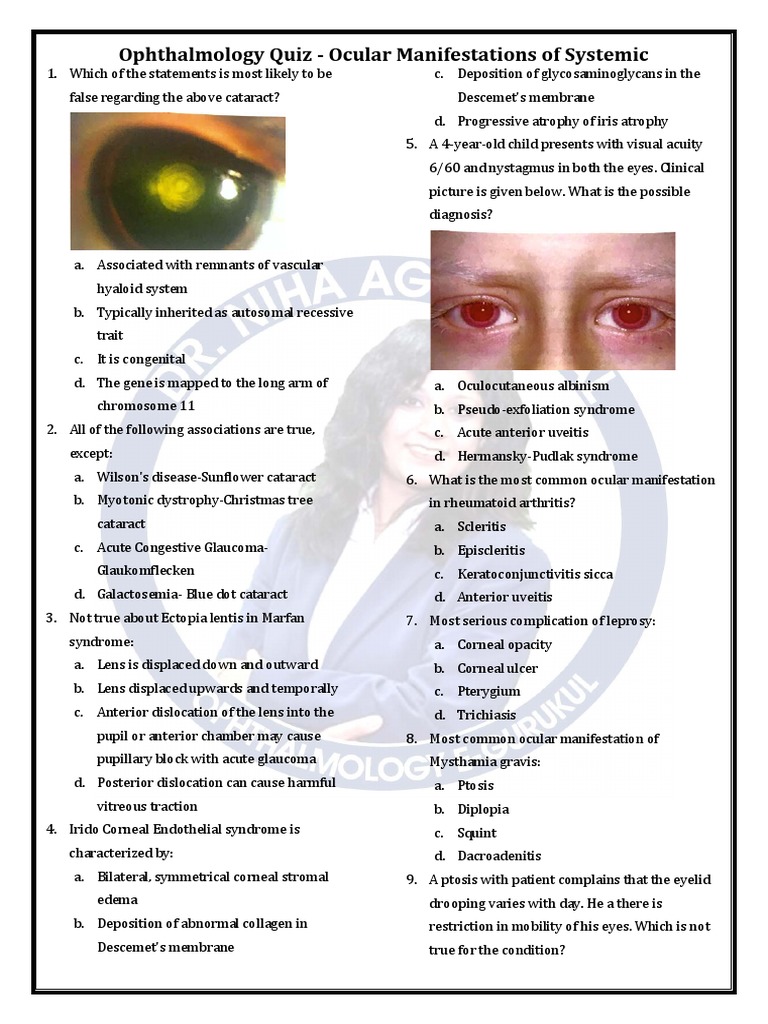 Ophtha Quiz - Ocular Manifestations of Systemic | PDF | Human Eye ...