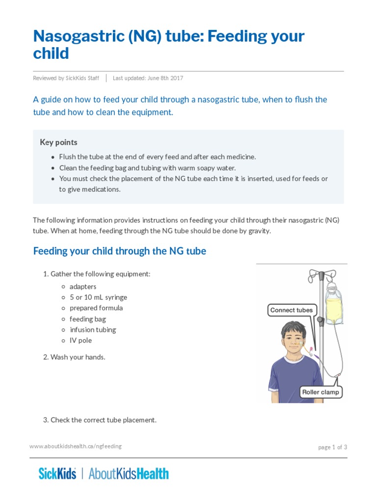 Nasogastric (NG) Tube - Feeding Your Child | PDF | Equipment | Health ...
