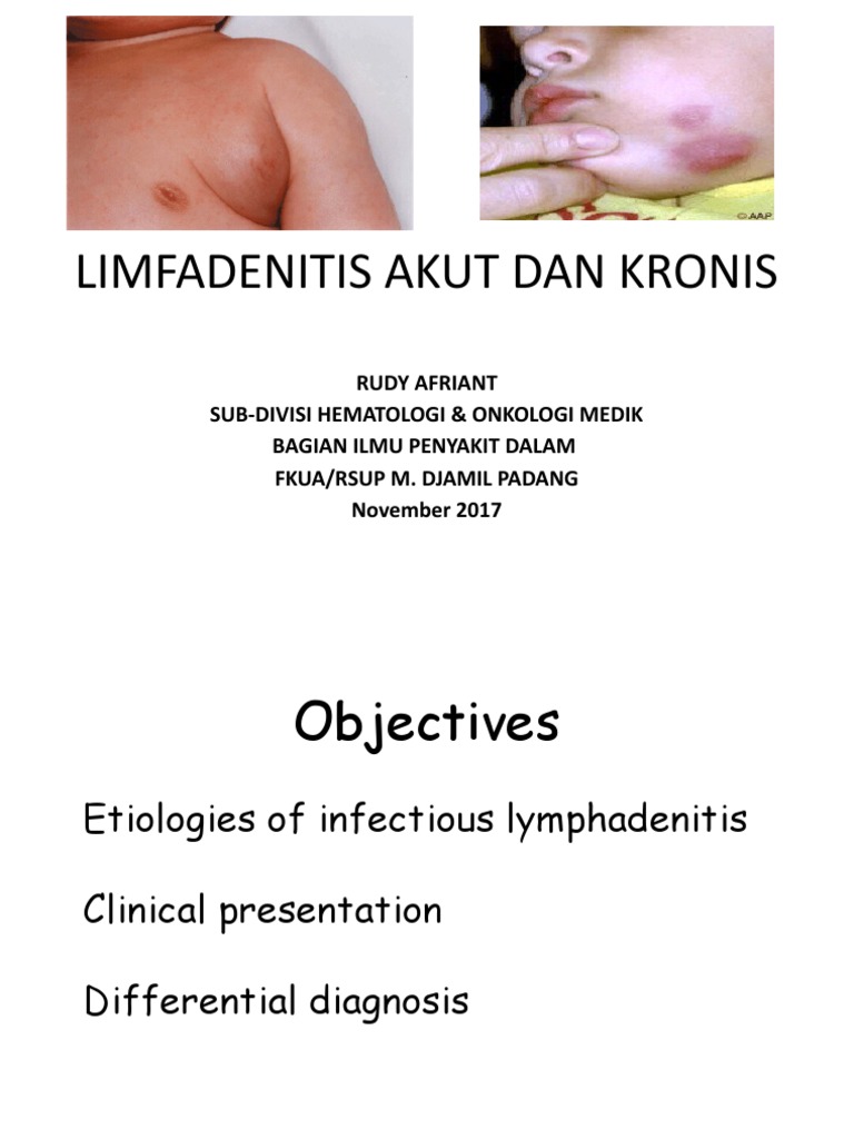 2.2.5.3 Limadenitis Akut Dan Kronis | PDF | Medical Specialties ...