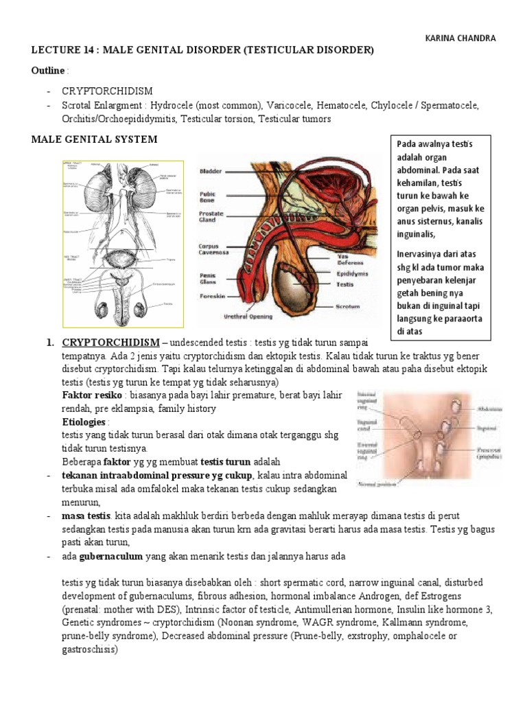 Gangguan Genital Pria: Cryptorchidism & Hydrocele | PDF | Pengembangan ...