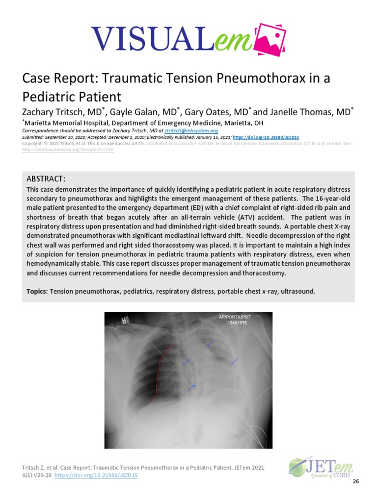 Traumatic Tension Pneumothorax in Pediatric patient | PDF | Thorax ...